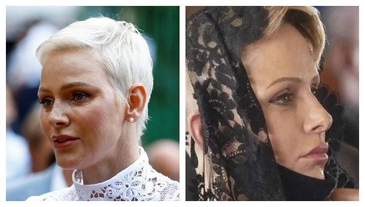 Labbra gonfissime e piena di cicatrici, Charlene di Monaco preoccupa tutti | FOTO