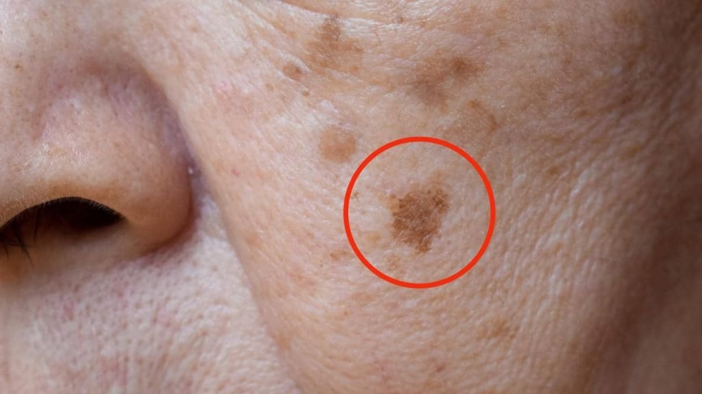 Come eliminare le macchie della pelle in modo naturale: ti basta fare ...