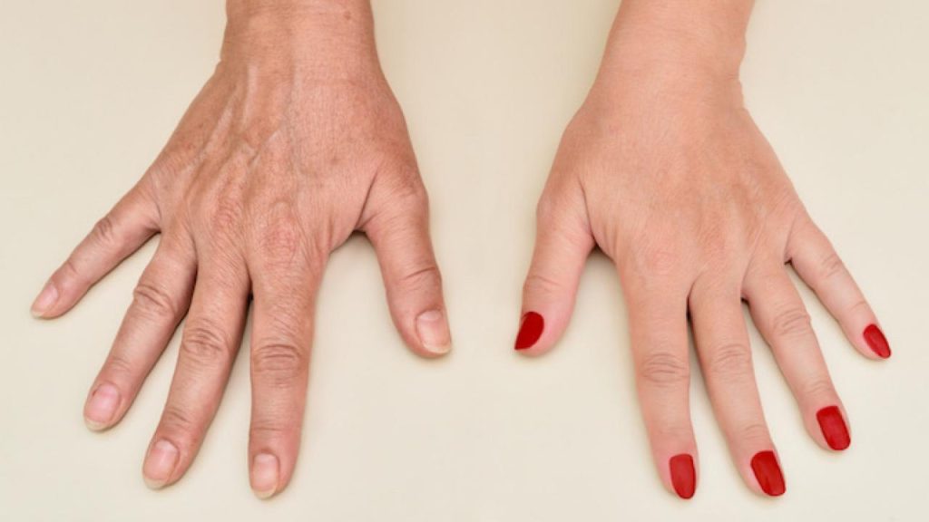 Il metodo asiatico per ringiovanire le mani dopo aver compiuto i 40 ...