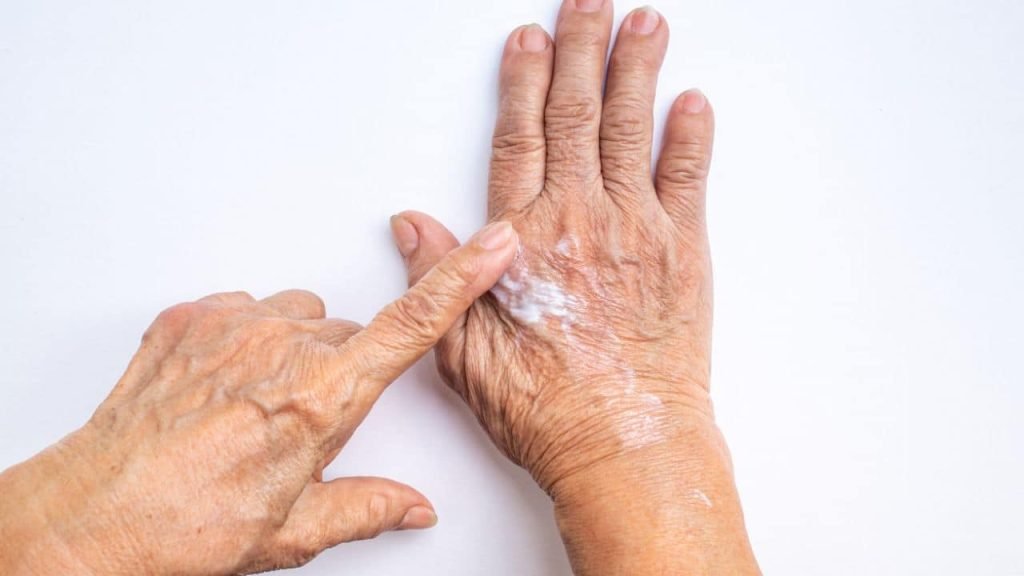 Con quest'amato ingrediente che conservi in cucina dimostrerai 10 anni ...